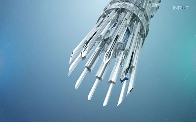 주식회사 오대 - 멀티 모발이식기 INRUT | 지식재산영상